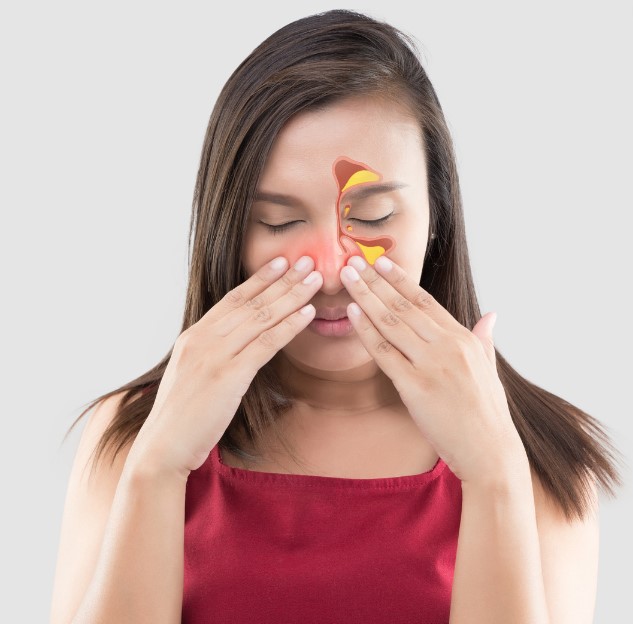 Apa Itu Sinus? Inilah Gejala dan Penyebabnya